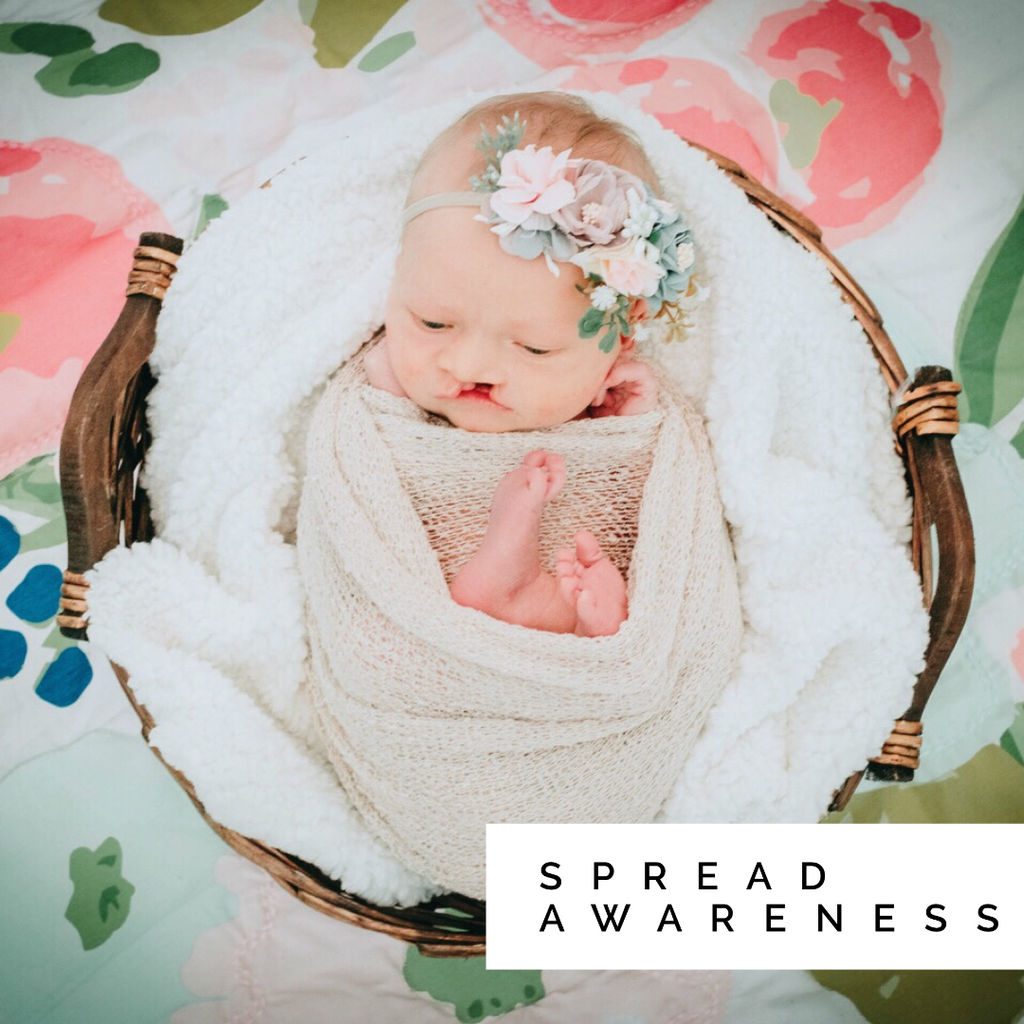 Cleft Lip and Palette Awareness – Littlest Warrior